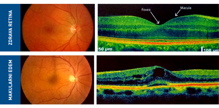 OCT - Ritz Poliklinika Zagreb